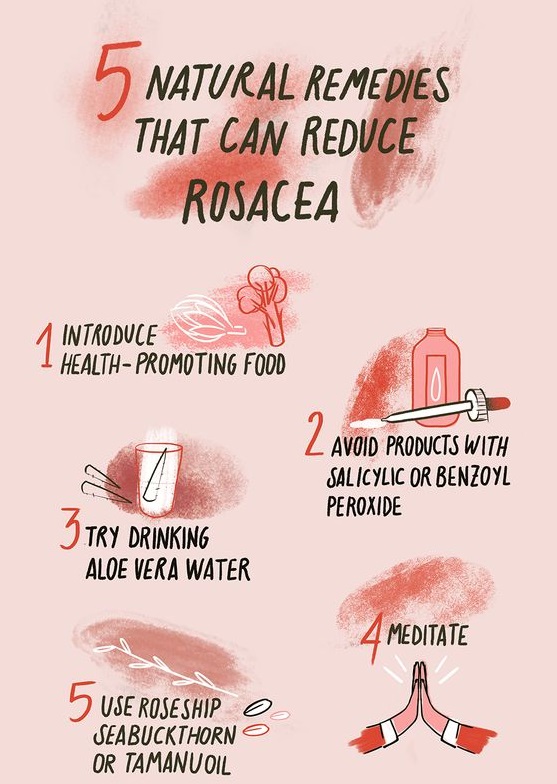 19 Home Remedies To Treat Pityriasis Rosea Naturally - soumyahospitals.com