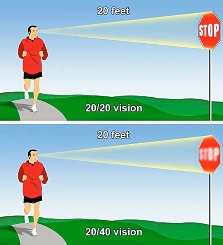 All You Need To Know About 20/30 Vision - soumyahospitals.com