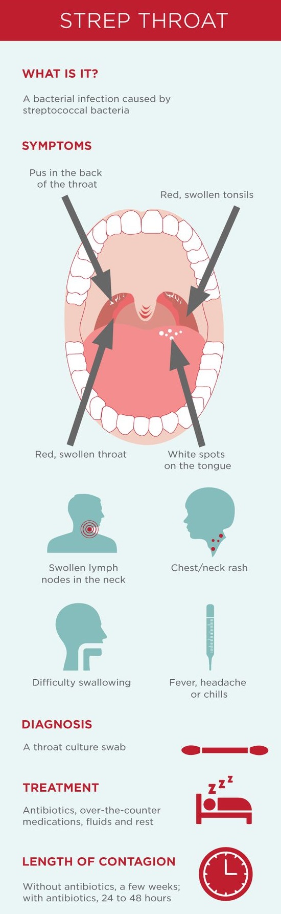Can You Get Strep Throat Without Tonsils? - soumyahospitals.com
