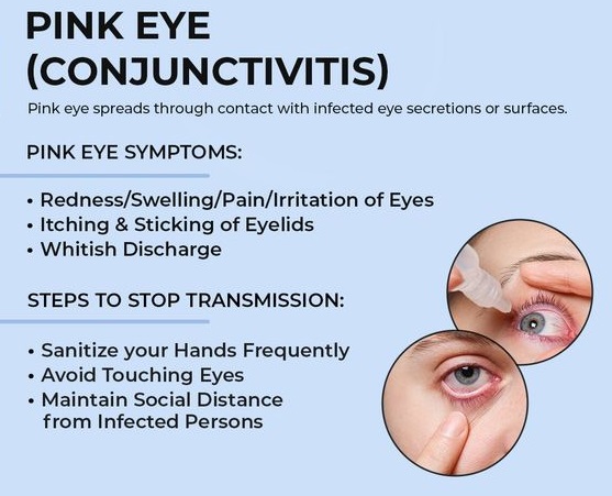 6 Causes Of Pink Eye (Conjunctivitis) - soumyahospitals.com