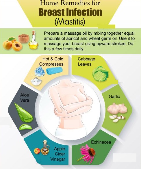 10 Home Remedies For Mastitis (Breast Infection) - soumyahospitals.com
