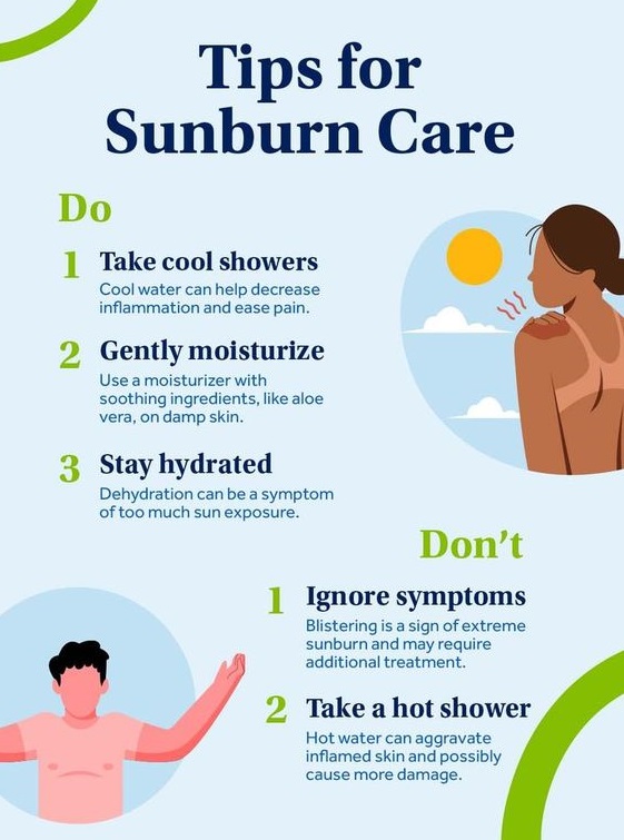 10 Effective Home Remedies To Treat Sunburn - soumyahospitals.com