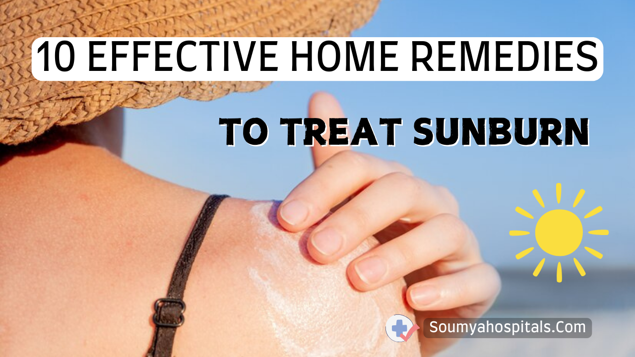 10 Effective Home Remedies To Treat Sunburn